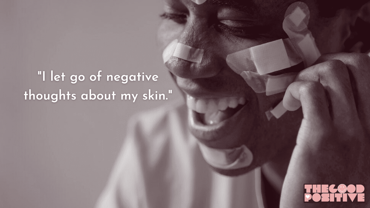 100 Positive Affirmations For Acne to Manifest Clear Skin!