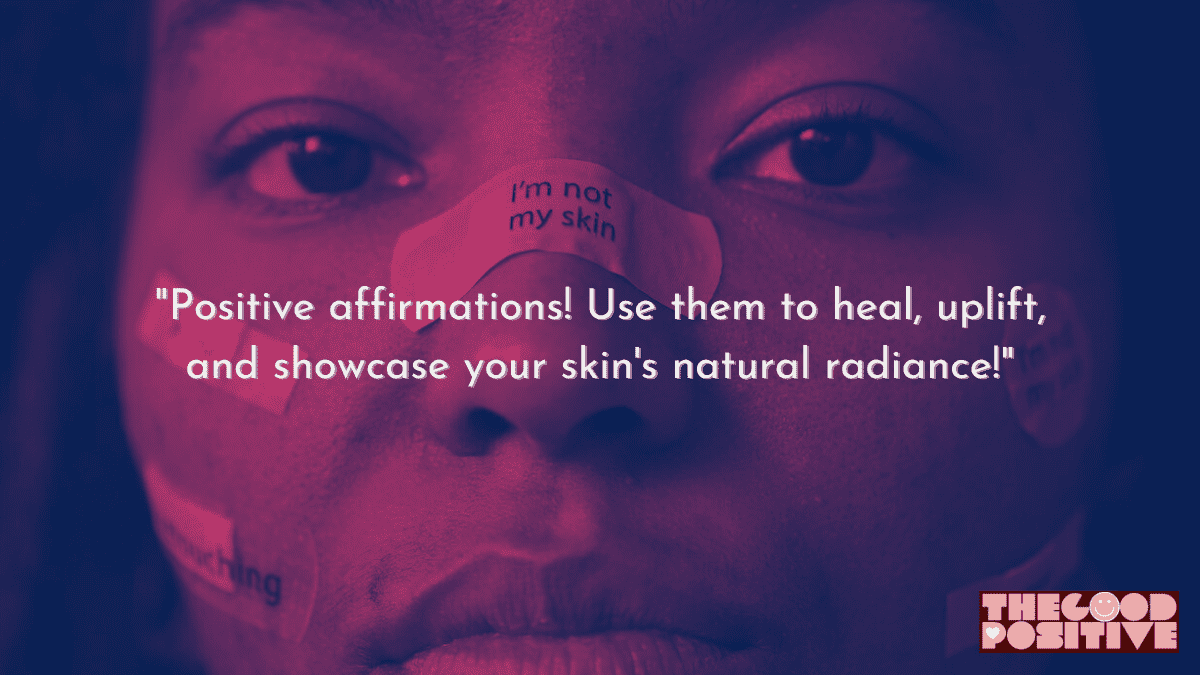 100 Positive Affirmations For Acne to Manifest Clear Skin!